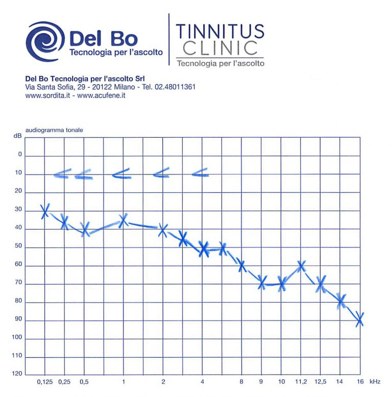 L'audiogramma: cos'è e come leggerlo | Sordità.it
